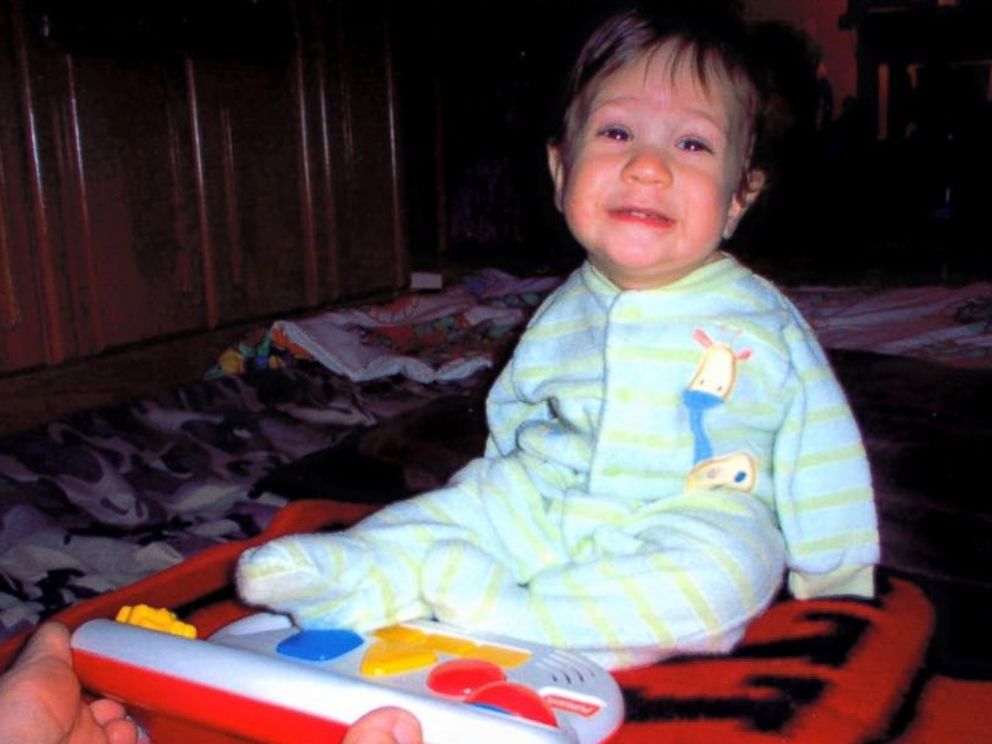 Câu chuyện truyền cảm hứng của Timmy Bannon - Khiếm khuyết nhưng không ...