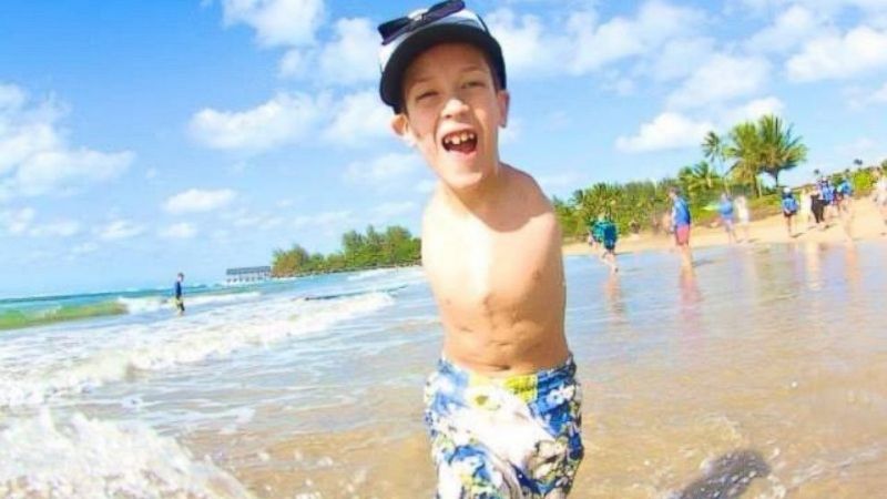 Câu chuyện truyền cảm hứng của Timmy Bannon - Khiếm khuyết nhưng không ...