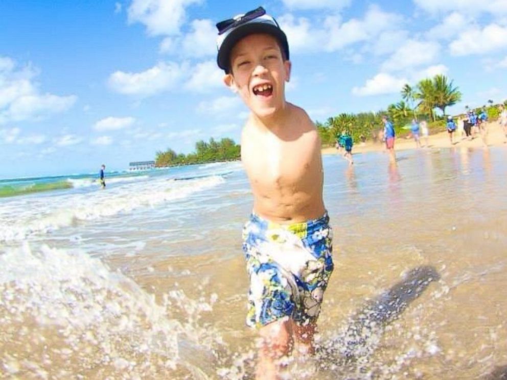 Câu chuyện truyền cảm hứng của Timmy Bannon - Khiếm khuyết nhưng không ...